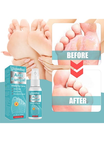 Anti Fungal Athletes Foot Spray- Prevent Athlete's Foot,Smelly Feet ...