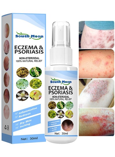 Natural Chinese Herbal Eczema And Psoriasis Spray, Dermatitis And ...