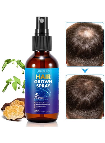 5% Minoxidil Hair Growth Spray for Longer Thicker Fuller Hair ...
