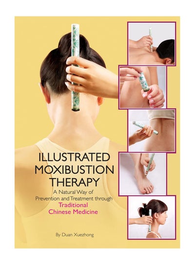 The Illustrated Moxibustion Therapy: A Natural Way of Prevention and Treatment through ...
