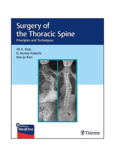 سعر Surgery Of The Thoracic Spine Principles And Techniques Hardcover